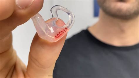 How 3d Printing Is Giving Refugees The T Of Hearing World Economic Forum