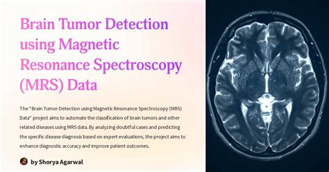 Brain Tumor Detection Using Magnetic Resonance Spectroscopy Mrs Data