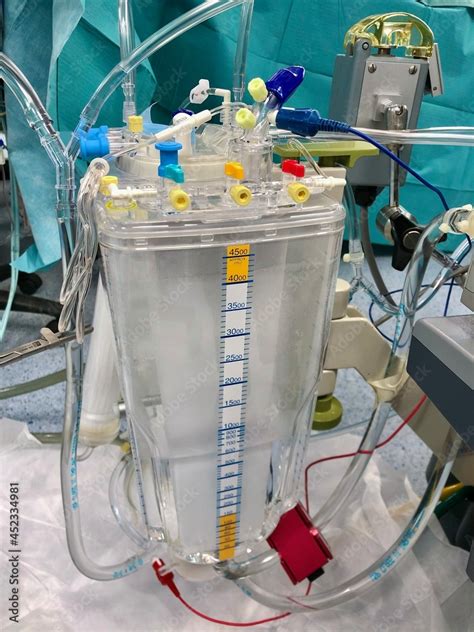 Venous Reservoir And Oxygenator Connected With Heart Lung Machine By Tubing Circuit For
