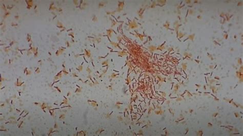 Bacillus In Gram Staining Archives Medical Notes
