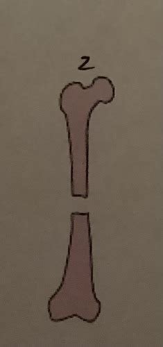 Fractures Flashcards Quizlet