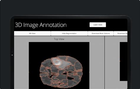 machine learning and interactive image processing with dash