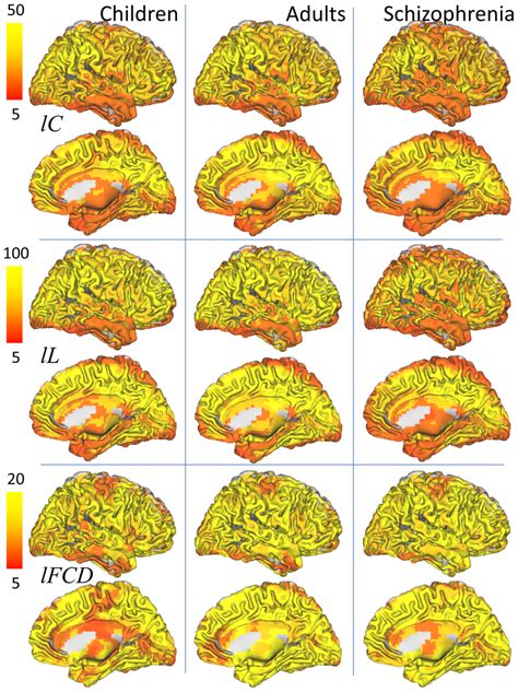 Statistical Significance Of Graph Theory Metrics T Score Maps Download Scientific Diagram
