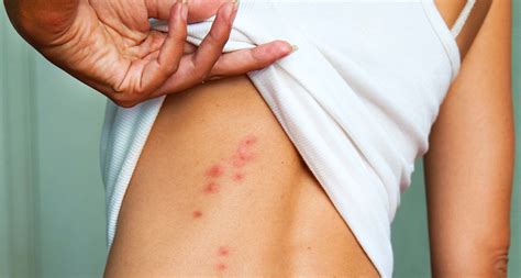 Bed Bug Services Avoid Bed Bugs This Summer