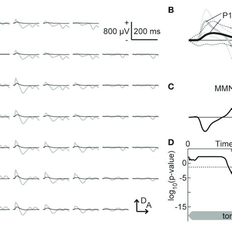 Tone Evoked Mismatch Negativity Mmn A Representative Mapping Of Download Scientific