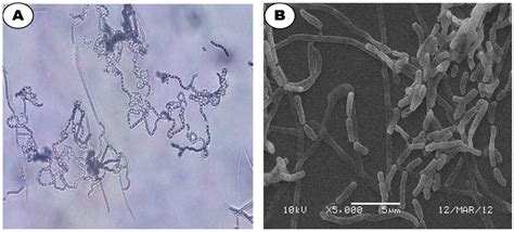 Metabolic Profiling Of Streptomyces Sp Strain Essamh1 Isolated From