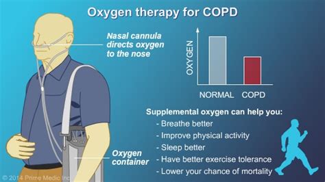 Treatment Copd Chronic Obstructive Pulmonary Disease