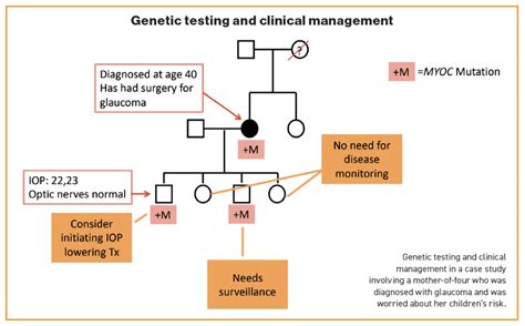 Can Genes Expose More Glaucoma In The Population Insight