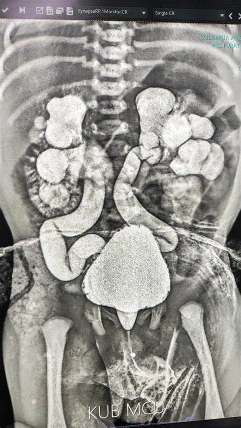 Nadeem Ali On Linkedin Mcu Radiology Radiologist Xray