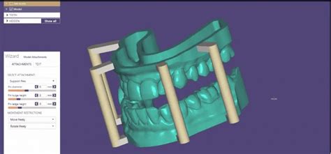 Exocad Model Creator Add On Module CAD Ray Com