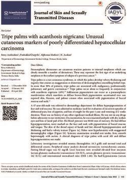 Tripe Palms With Acanthosis Nigricans Unusual Cutaneous Markers Of