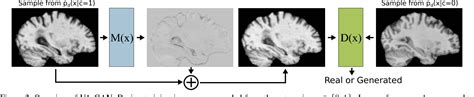 Figure 2 From Visual Feature Attribution Using Wasserstein Gans Semantic Scholar