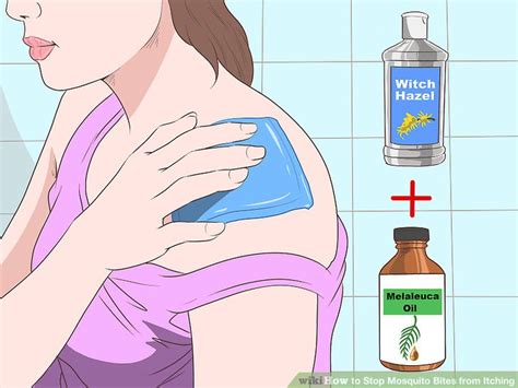 4 Ways To Stop Mosquito Bites From Itching WikiHow
