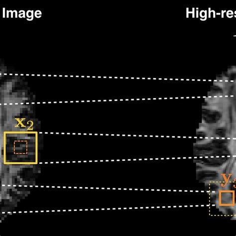 Illustration Of The Patch Wise Regression In Super Resolution