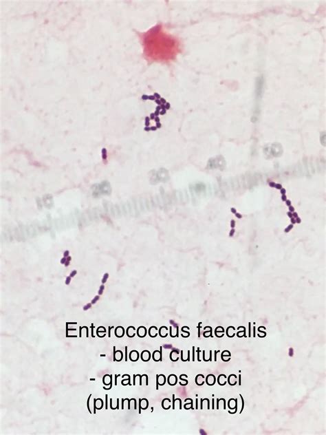 Enterococcus Faecalis Gram Stain