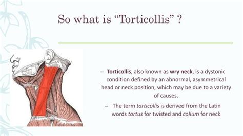 Torticollis And Its Pt Management Pptx