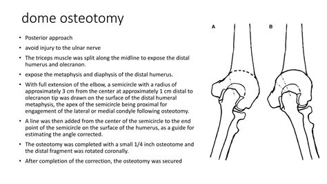 Cubitus Valgus Varus Pptx