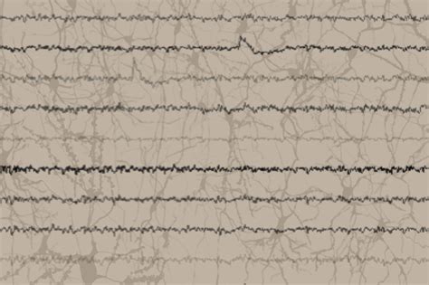 What Does The Eeg Signal Measure Sapien Labs Neuroscience Human