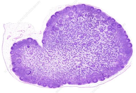 Lymph Node Histology Paracortex Lymph Node Tutorial Histology