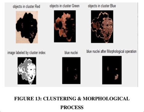 shows otsu segmentation which performs thresholding it separates the