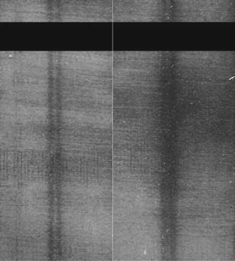 Detector Image See Text Left And Right Detector Plate 11