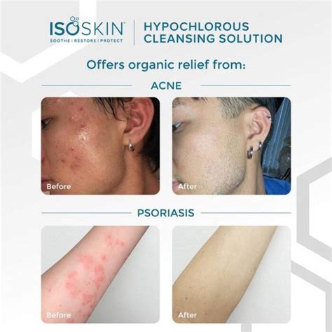 Isoclean Isoskin Hypochlorous Cleansing Solution Spray 525ml Beauty Kick