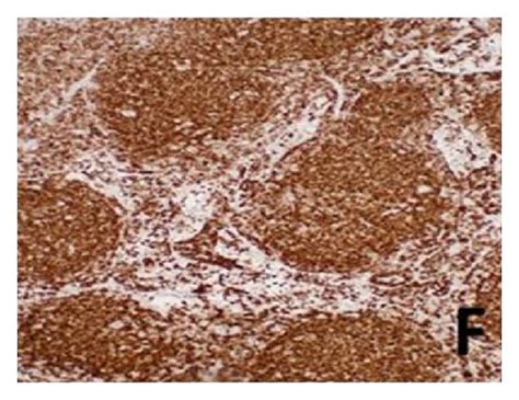 H And E And Immunohistochemical Staining Of Follicular Components Download Scientific Diagram