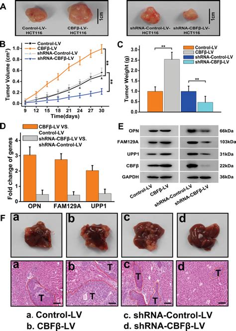Cbfβ Promotes Colorectal Cancer Progression Through Transcriptionally Activating Opn Fam129a