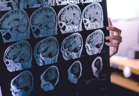 Simpel Test Afslører Hjernens ældning Illviddk