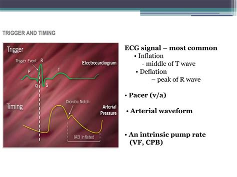 Intra Aortic Ballon Pump Iabp Ppt