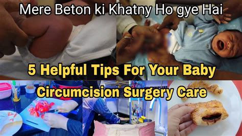 Circumcision Care For Your Baby / How To CARE After Circumcision Surgery / Daily Routine - YouTube