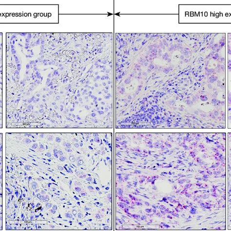 Rbm10 Mrna Expression Was Evaluated By Rna In Situ Hybridization Using