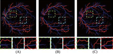 Comparison Of Model Performance For Baseline And Proposed Method A Download Scientific