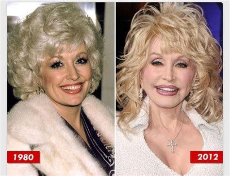 Dolly Parton Then And Now Celebrities Before And After Dolly Parton