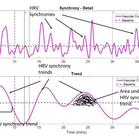 Example Of Synchrony Analysis In A Vascular Surgical Pair A Shows