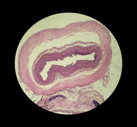 Esophagus Diagram Quizlet