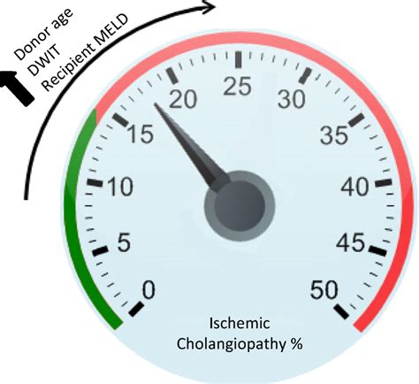 Dial Of Ischemic Cholangiopathy Risk With Increasingly Riskier Dcd Download Scientific Diagram