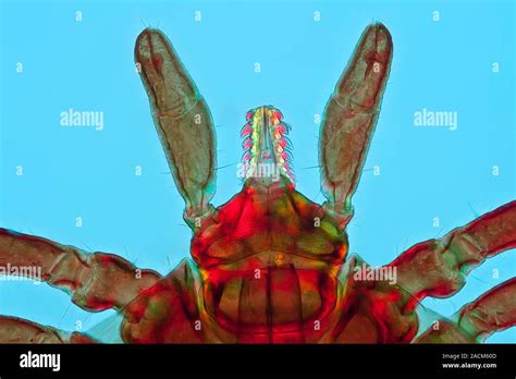 Tick Light Micrograph Of The Head Of A Male Castor Bean Tick Ixodes Ricinus Showing Its