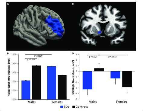 Region Of Interest Roi Analysis Ac Areas In Blue Illustrate The Download Scientific
