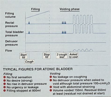 Urine Void Chart