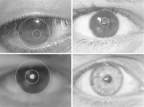 Examples Of Incorrect Segmentation Download Scientific Diagram