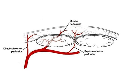 图文详解:穿支皮瓣的解剖与进展! 德医医学 助力医学教育发展! 图文详解:穿支皮瓣的解剖与进展! 德医医学 助力医学教育发展!