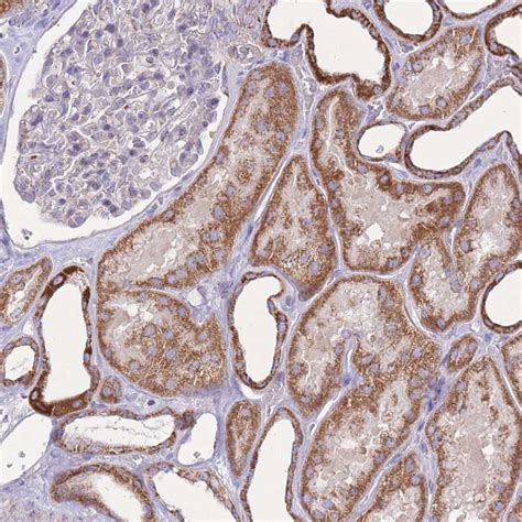Rabbit Polyclonal Anti Pdha1 Antibody Buy For Research Highly