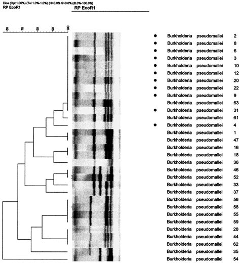 Comparison Of Rapid Automated Ribotyping And Dna Macrorestriction Analysis Of Burkholderia