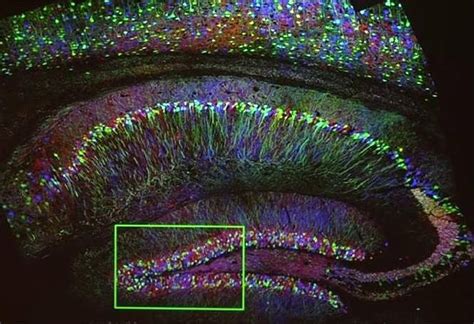 마인드라이프 주의력 Emdr 과립세포들입니다 사각형 부분은 나이들어서도 과립세포들이 만들어 지는 곳 입니다 과립세포들은 우리 뇌의 기억을 생성하는 세포들입니다 하루