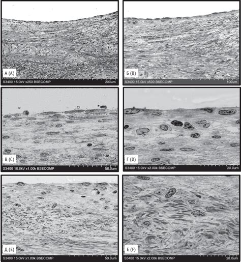 Structure Of Pulmonary Artery Neointima Adjacent To The Bare Metal Download Scientific Diagram