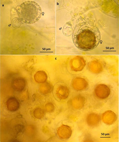 Stages Of Oospore Maturation In Peronospora Effusa Within The Leaf