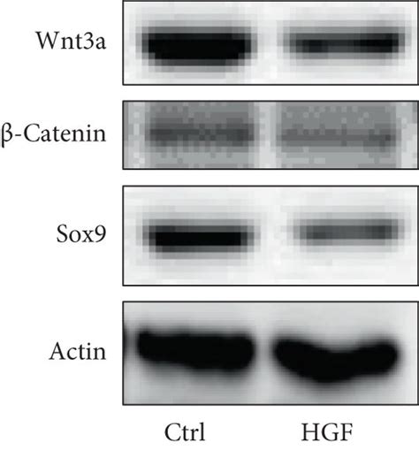 Wnt Signaling Pathway Was Involved During Hepatic Differentiation Of Download Scientific