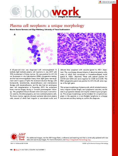 Pdf Plasma Cell Neoplasm A Unique Morphology