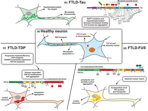 The Three Main Types Of Ftd Pathology Are Characterized By The Download Scientific Diagram